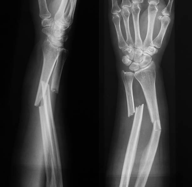 Our Services - AI X-Ray Diagnosis